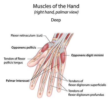 More About Flexor Tendon Injury What You Need To Know